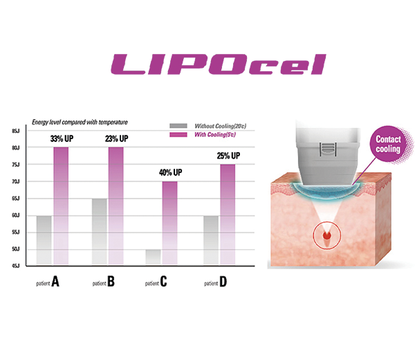 LIPOcel™ | Healthxchange Pharmacy